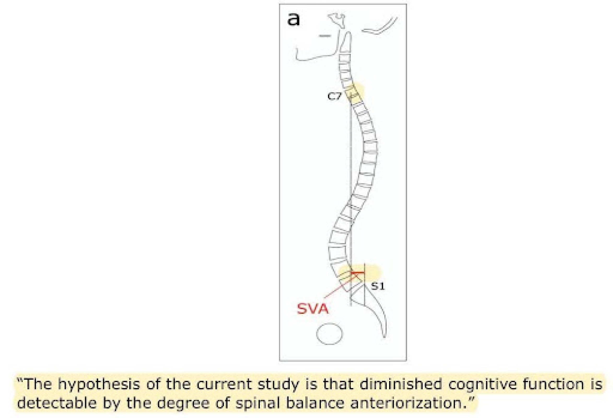 The Benefits of Postural Analysis | The American Chiropractor | JULY 2025