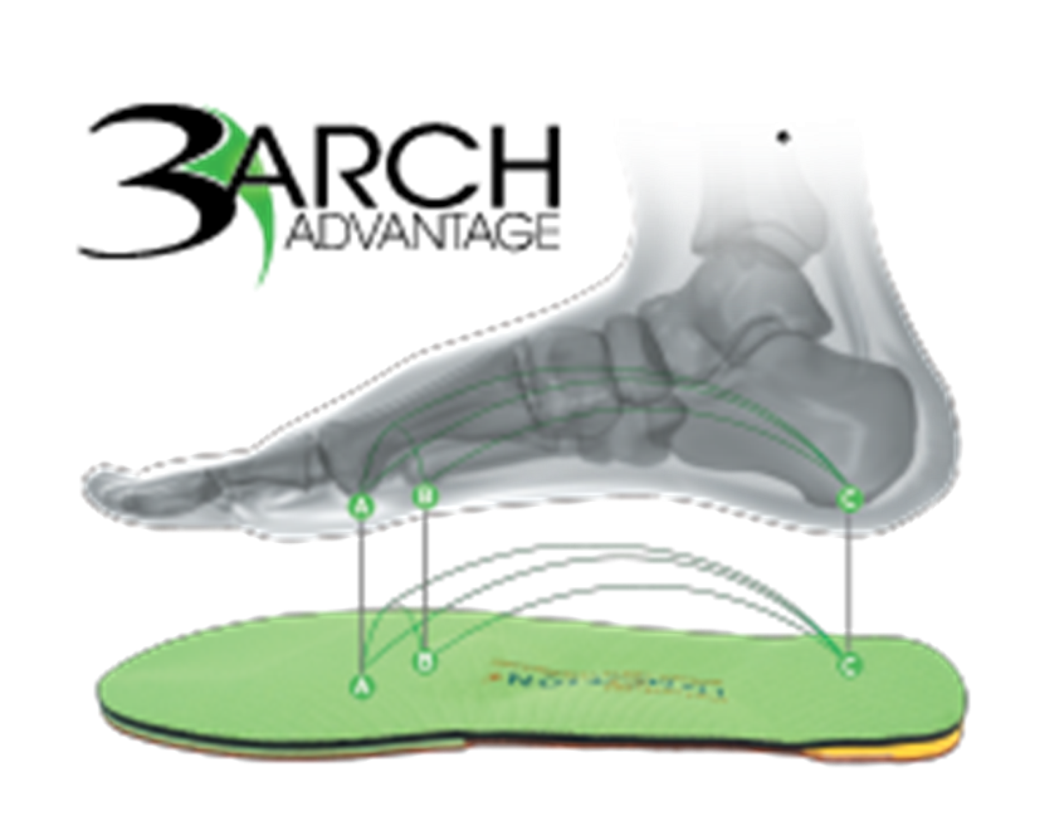 How the Three Arches in Your Foot Impact Spinal Stabilization | The ...